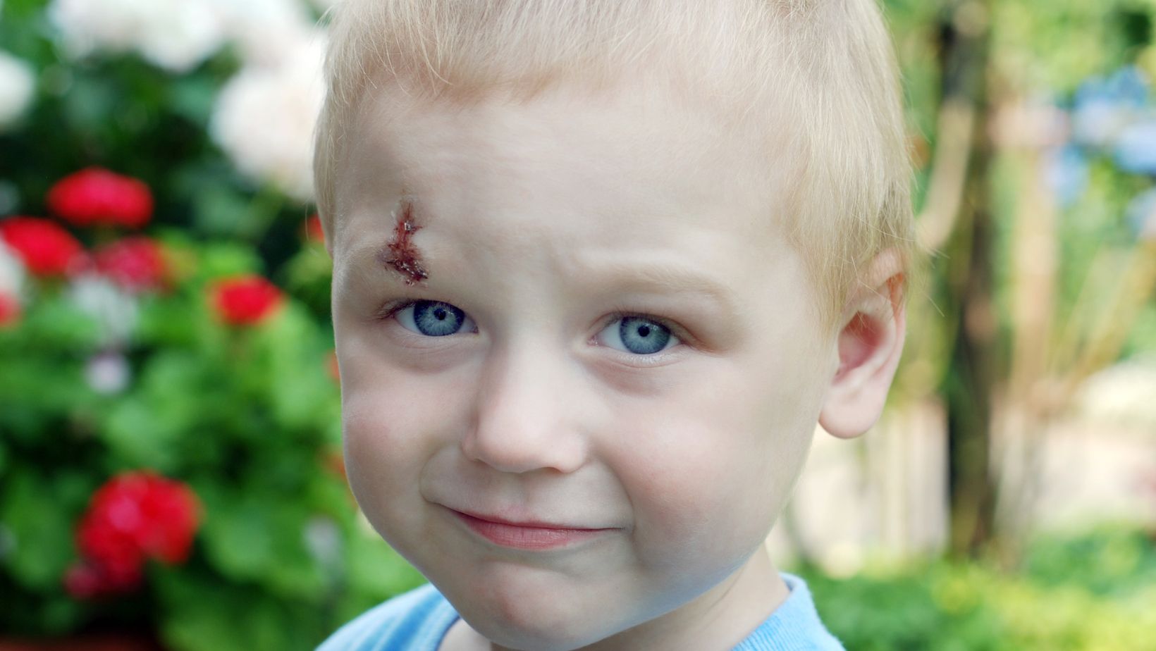 Making a Personal Injury Claim for Your Child: What You Need to Know ...